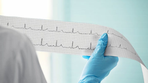 Cardiac Procedures | Advanced Cardiovascular Clinic